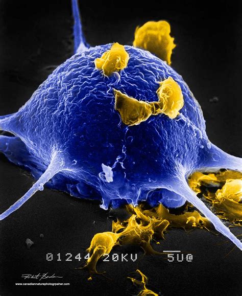 Scanning Electron Microscpy Photography By Robert Berdan The Canadian