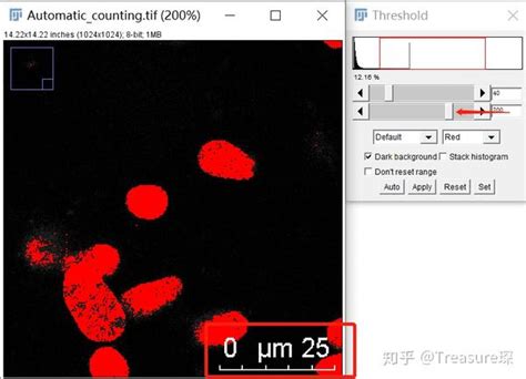 Imagej实用技巧——自动细胞计数 解放双手篇 知乎