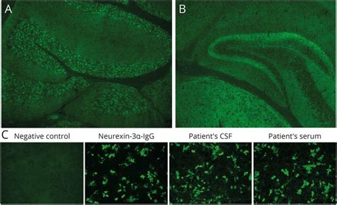 Neurexin 3α Antibody By Tissue Ifa And Cell Based Assay Download