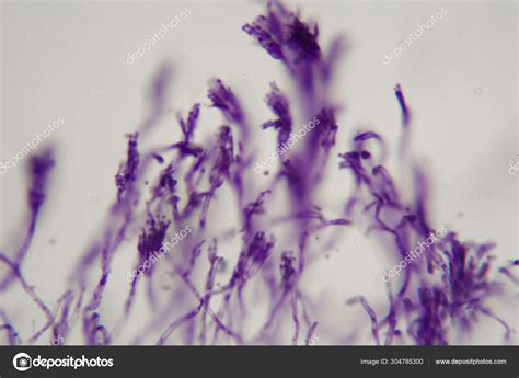 Penicillium Fungi Microscope