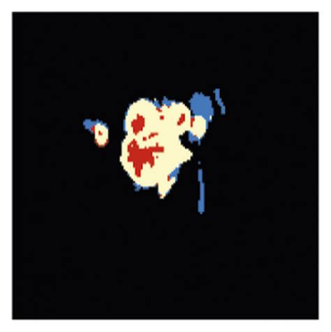 Case 3 The Image Is Characterized By Complex Edges And Many Contour