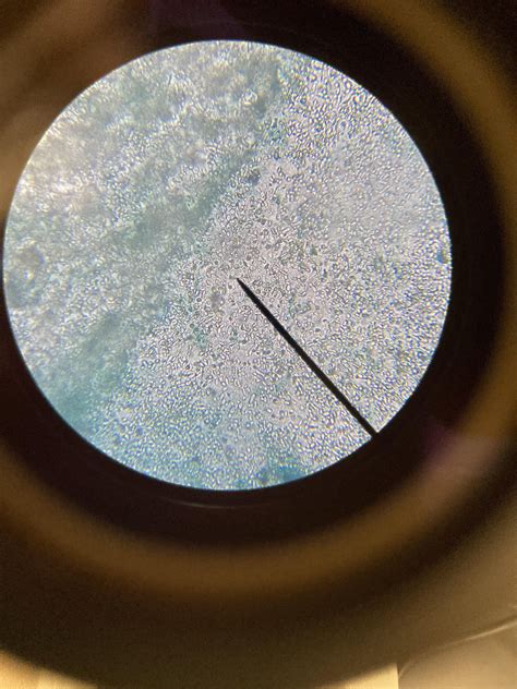 Scoby Bacteria Under A Microscope Stained Thanks To My Biology Teacher For Letting Me Borrow