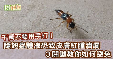 千萬不要用手打！隱翅蟲體液恐致皮膚紅腫潰爛 3關鍵教你如何避免 粉健康
