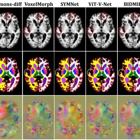 Qualitative Comparison Of The Results Achieved On A Pair Of Fixed And