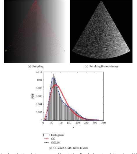Figure 9 From A Generalized Gamma Mixture Model For Ultrasonic Tissue Characterization