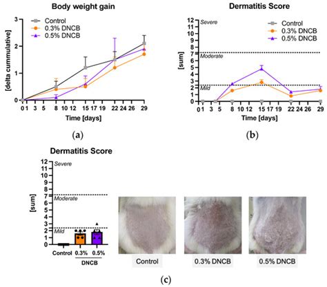 Establishment And Characterization Of Mild Atopic Dermatitis In The
