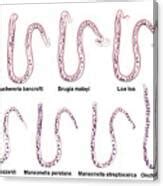 Comparison Of Microfilariae Morphology Photograph By Kateryna Kon