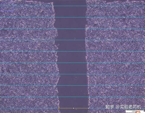 手把手教学——划痕实验（细胞迁移）的实验流程及经验分享 知乎