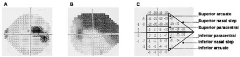 Visual Field Scoring The Average Pattern Standard Deviation Psd In