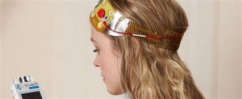 Tdcs Therapy In Toronto Transcranial Direct Current Stimulation Vieclinic