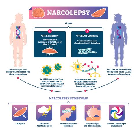 Cataplexy A Rare And Complex Sleep Disorder