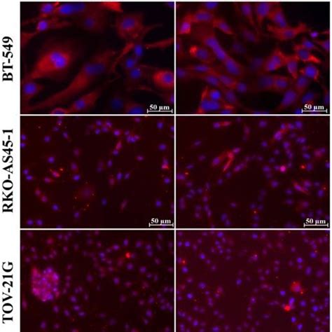 Immunofluorescence Analysis Of The Mesenchymal Marker Fibronectin Download Scientific Diagram