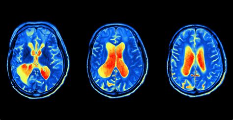E Prime® Extensions For Fmri Psychology Software Tools