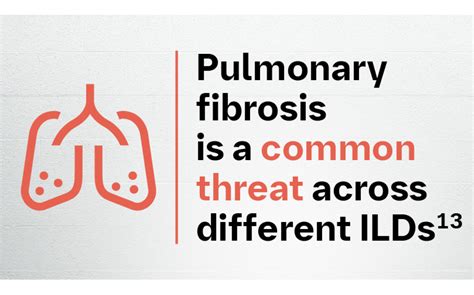 Recognizing Interstitial Lung Diseases Ilds Sound The Ild Alarm