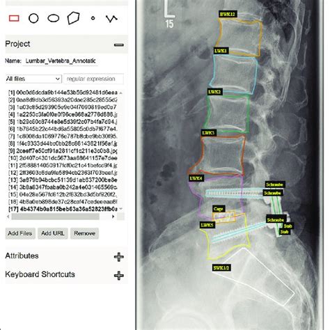 Screenshot Of The Via Annotation Tool With Manual Annotations Of A Download Scientific Diagram