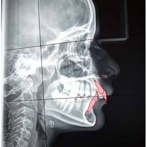 Analysis Done In Facad Software Download Scientific Diagram