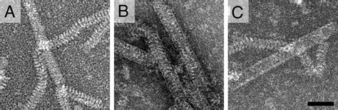 Electron Cryotomography Of Measles Virus Reveals How Matrix Protein