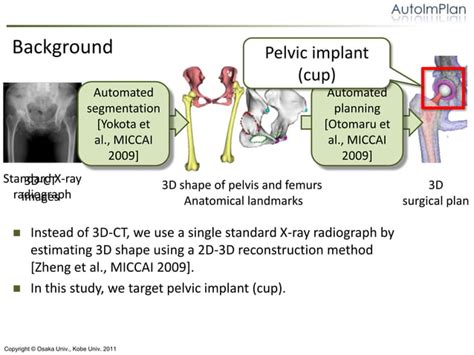 An Automated 3d Cup Planning In Total Hip Arthroplasty From A Standard X‑ray Radiograph Using