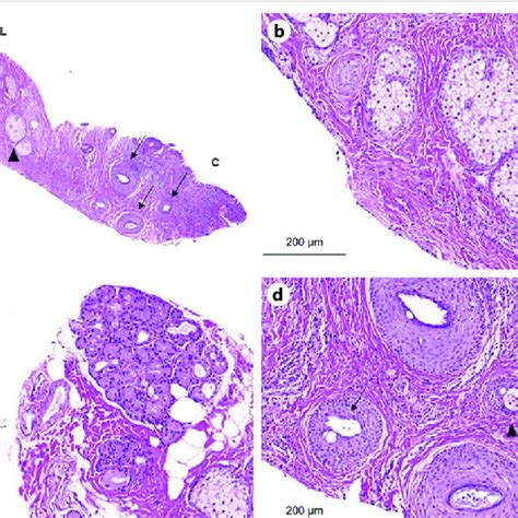 Clinical Picture A Overview Of The Conjunctival Tarsal Lesion Download Scientific Diagram
