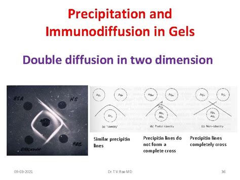 Antigen And Antibody Reactions Detection By Precipitation Methods