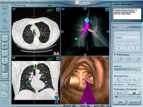 Safety Of Pacemakers And Defibrillators In Electromagnetic Navigation