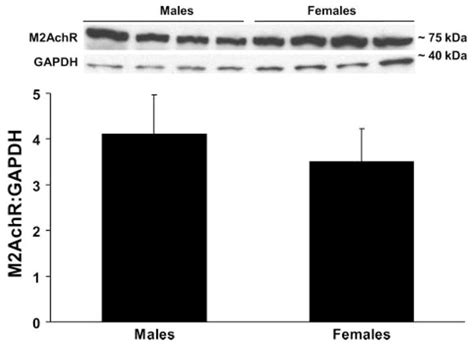Male Sex Hormones Promote Vagally Mediated Reflex Airway Responsiveness To Cholinergic