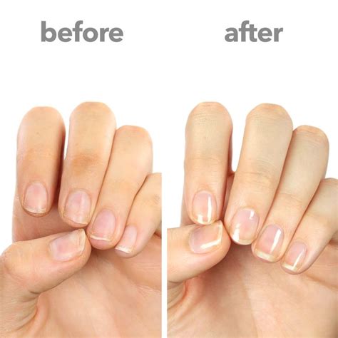 First Aid Kiss Nail Strengthener 3 Pack Strengthen Nails After