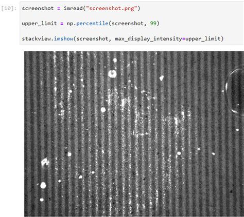 Microscopic Blur Detection Using Laplacian Image Analysis Imagesc
