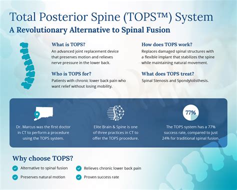 Total Posterior Spine Tops System Elite Brain And Spine