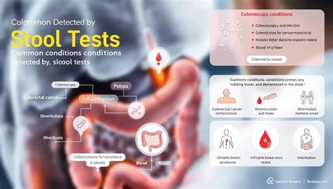 Understanding The Stool Test Your Guide To Bowel Health Screening