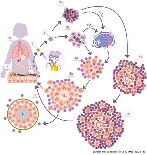 Tuberculosis Mind Map