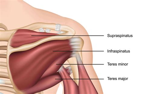 Rotator Cuff Tendonitis Motus Physical Therapy