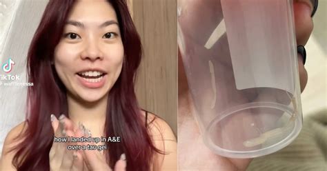 Bean Sprout Stuck In Throat Sporean Woman Spends 9 Hours At