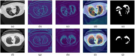 From Left To Right A E F J Views Of A CT Scan Feature Maps Before Download Scientific