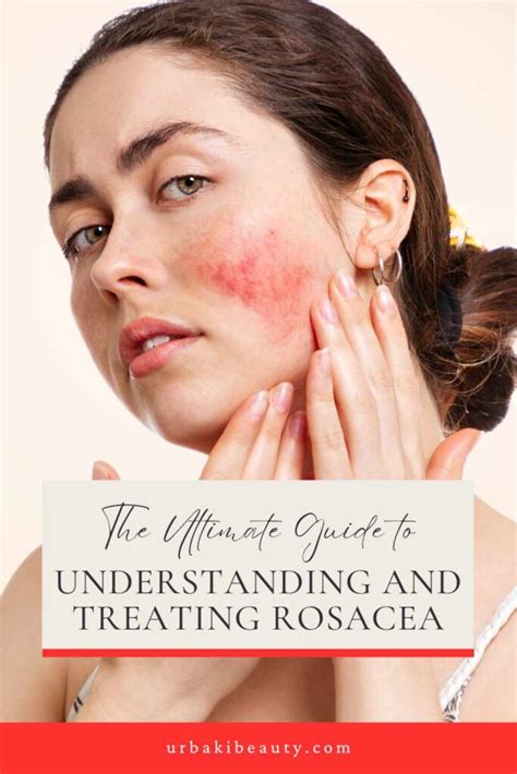 The Ultimate Guide To Understanding And Treating Rosacea