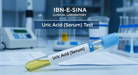 Uric Acid Test At Ibn E Sina Lab 100 Accurate And Affordable