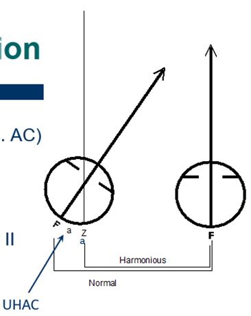 ARC Mechanisms Understanding The Angles Flashcards Quizlet