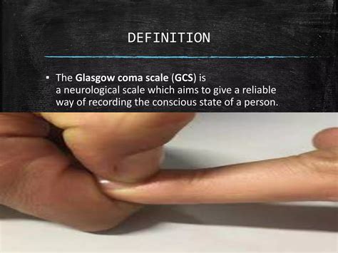 Gcs Glasgow Coma Scale Pptx