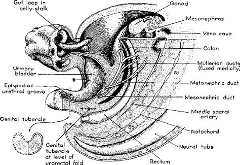 Figure 9 From The Genesis Of Exstrophy Of The Bladder And Epispadias