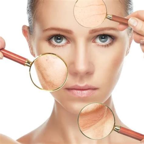 How To Treat Dry Patches On Your Skin Causes And Solutions Goldsupplier