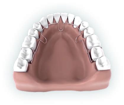 Alf Therapy Alf Appliance Orthodontics Early Dental Care