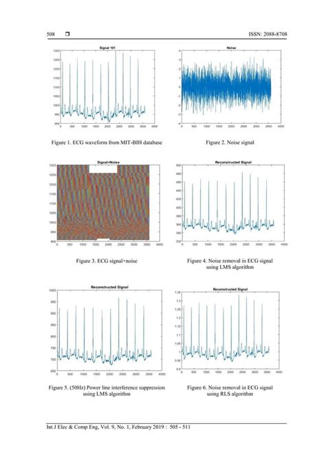 Noise Reduction In Ecg Signals For Bio Telemetryb Pdf Digital Audio
