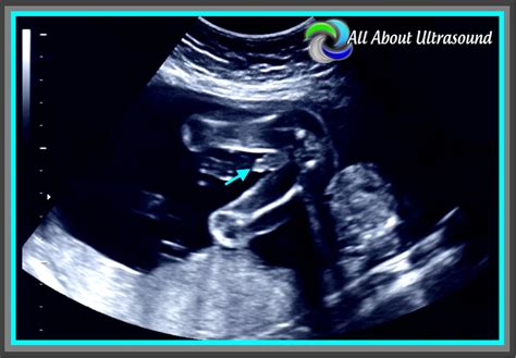 Best Practice Tips To OB GYN Ultrasound