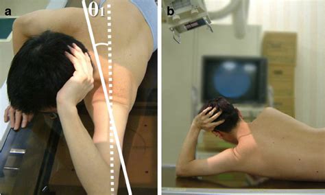 A Modified Bernageau Method Patients Lie On Their Axilla In Their Most