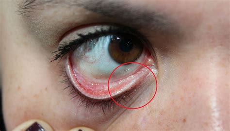 ¿por Qué Tenemos Un Agujero Dentro Del Ojo ¡no Es La Salida De Las