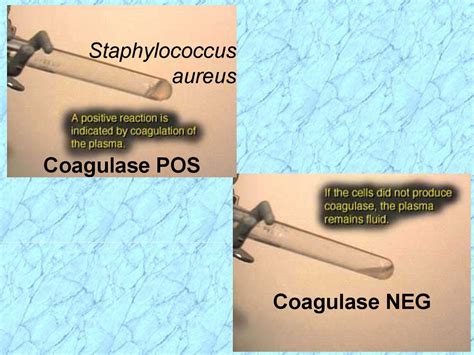Staphylococcus Classification презентация онлайн