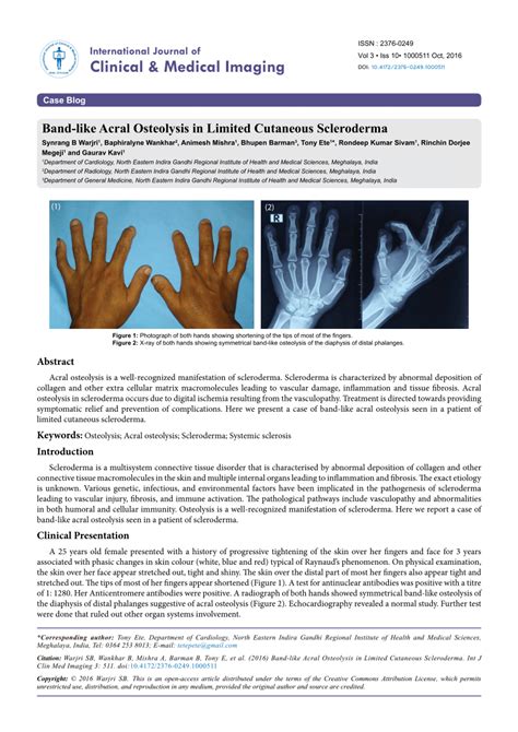 Pdf Case Blog International Journal Of Clinical And Medical Imaging Band Like Acral Osteolysis