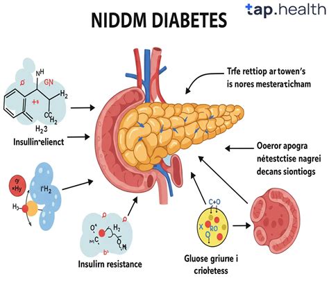 What Is Niddm Diabetes A Simple Guide