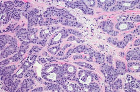 Colorazione Ematossilina Eosina Immagine Foto E Immagini Stock Istock