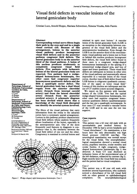Visual Field Defects In Vascular Lesions Of The Lateral Geniculate Body Docslib